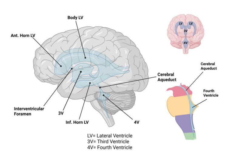 Station 1. Meninges and ventricles - Medicine Digital Learning